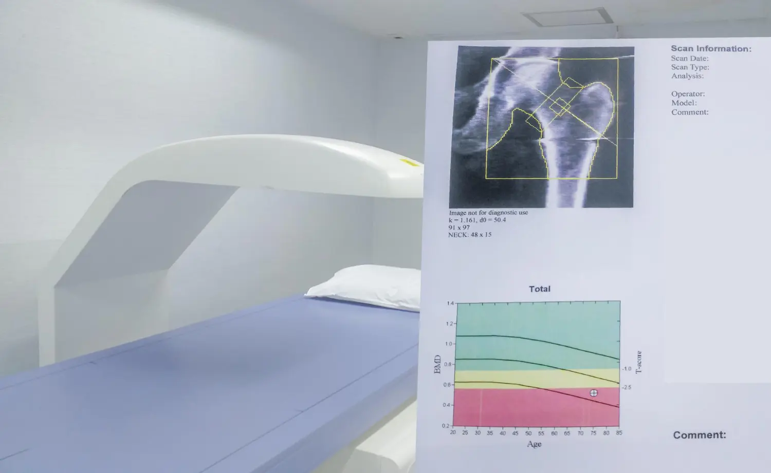 DEXA-scan - MediMaison Lichtaart